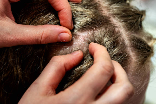 4 miljoen kijkers voor documentaire Luizenmoeder